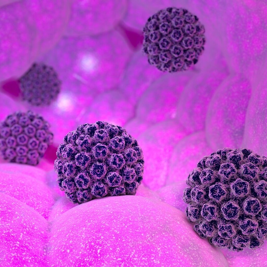 Condilomas – Dr. Jorge Alberto Elías